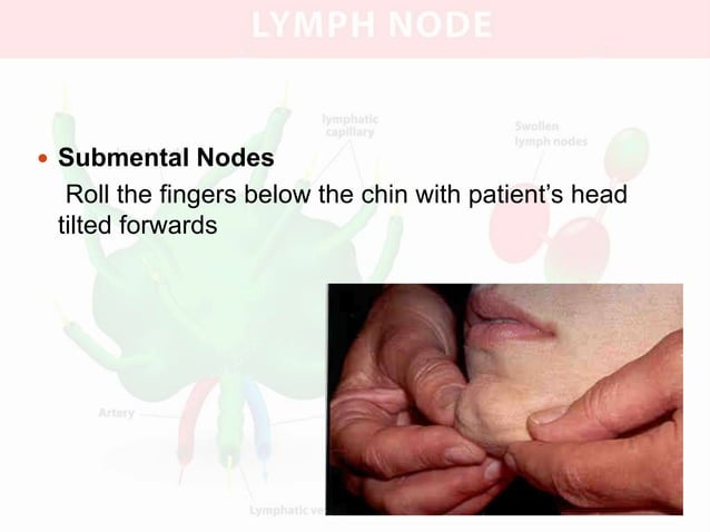 EXAMINATION OF LYMPH NODE..pptx