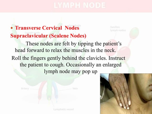 EXAMINATION OF LYMPH NODE..pptx