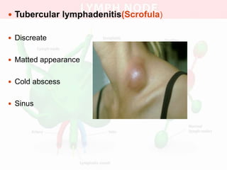 EXAMINATION OF LYMPH NODE..pptx