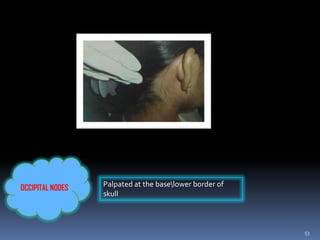 Examination of lymphnodes and cervicofacial lymphadenopathy | PPTX
