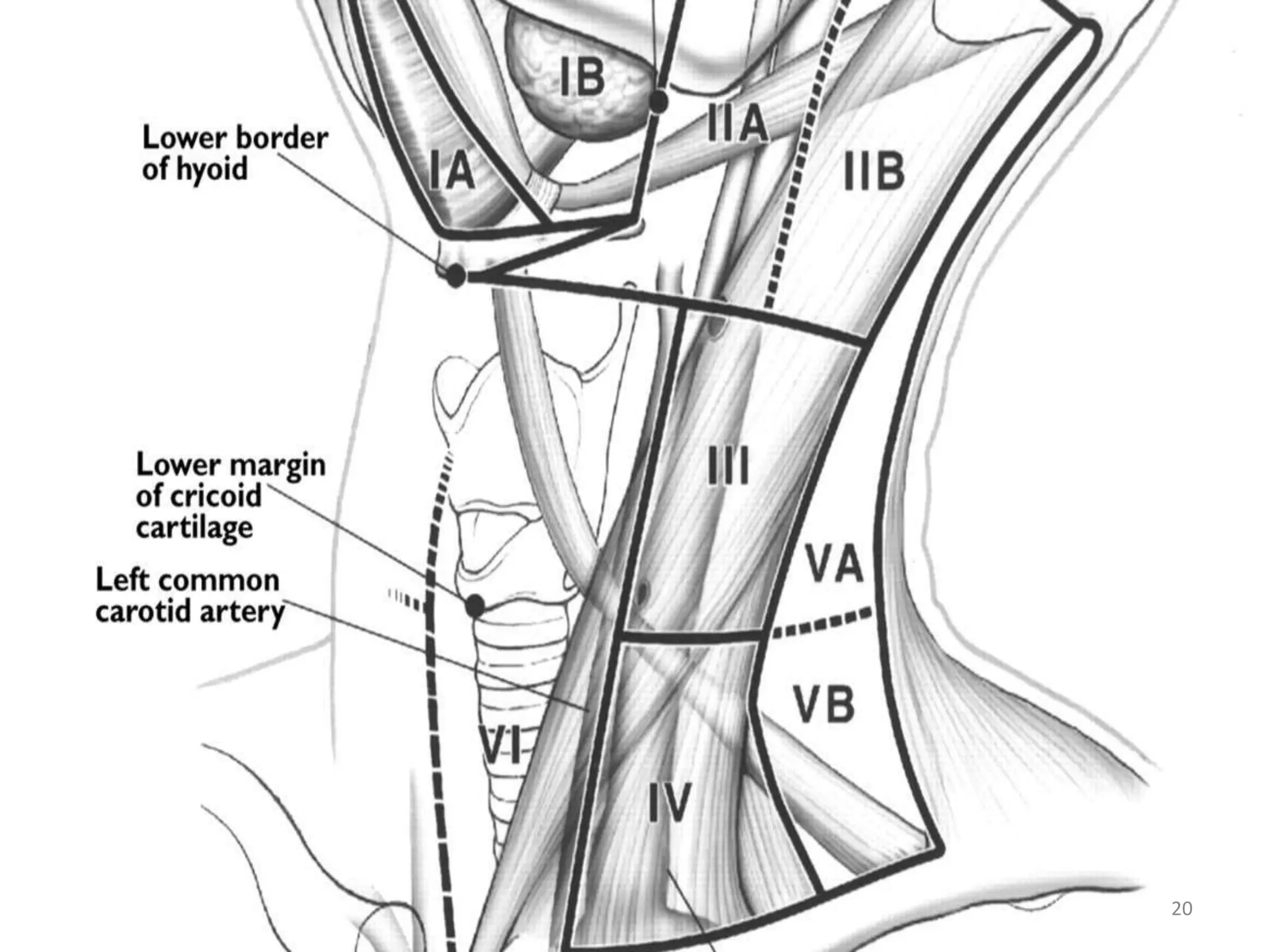 Examination of lymph nodes of head and neck | PPTX