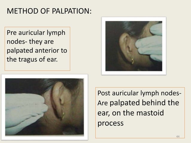 Examination of lymph nodes of head and neck | PPTX