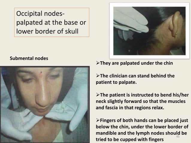 Examination of lymph nodes of head and neck | PPTX