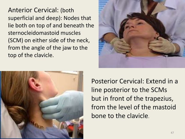 Examination of lymph nodes of head and neck | PPTX