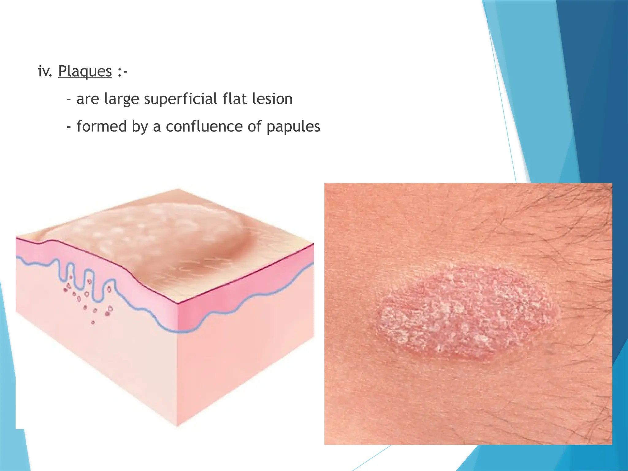 Examination of Lymphoglandular & Integumentary System.pptx