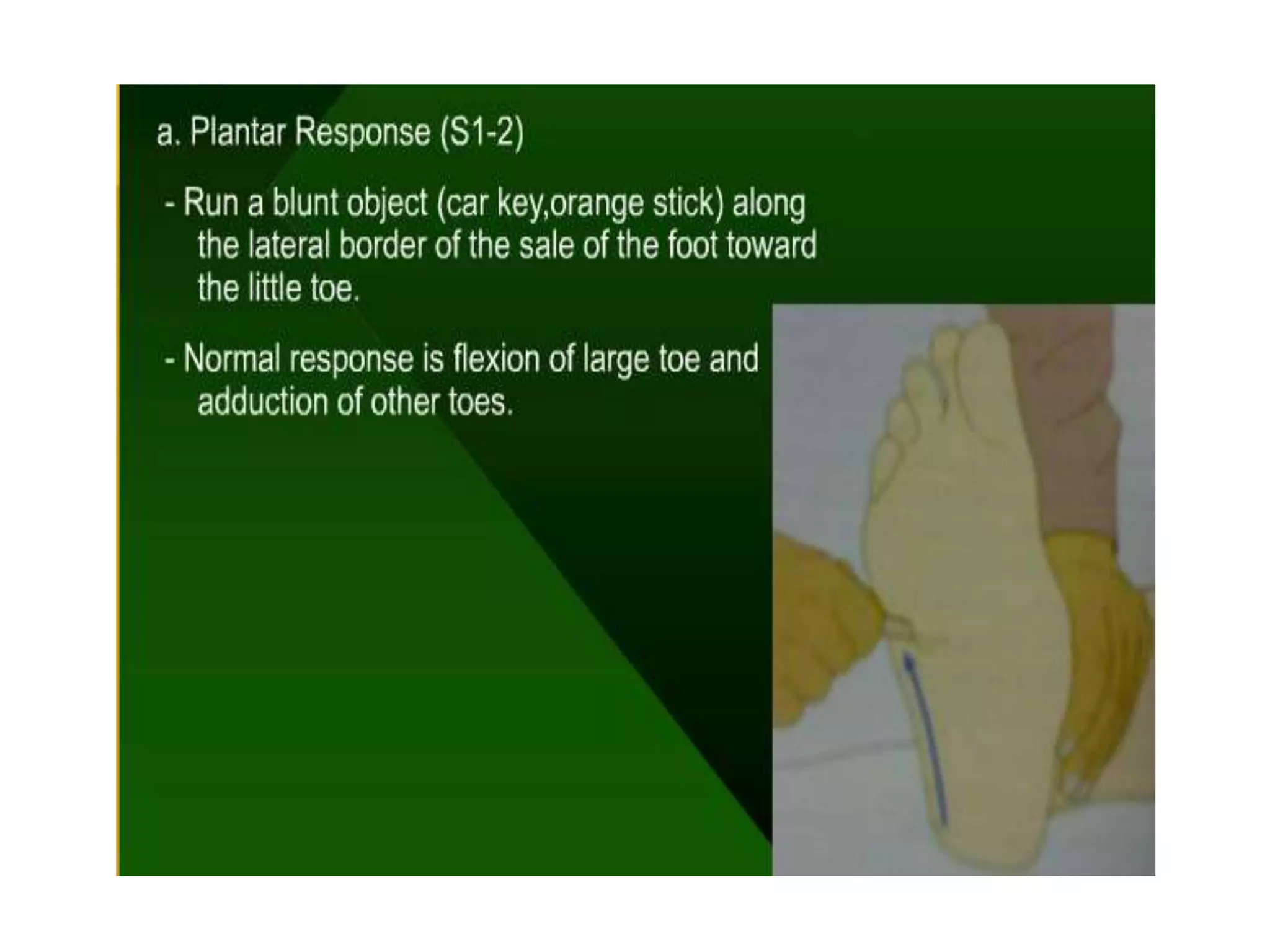 Examination of motor system | PPTX