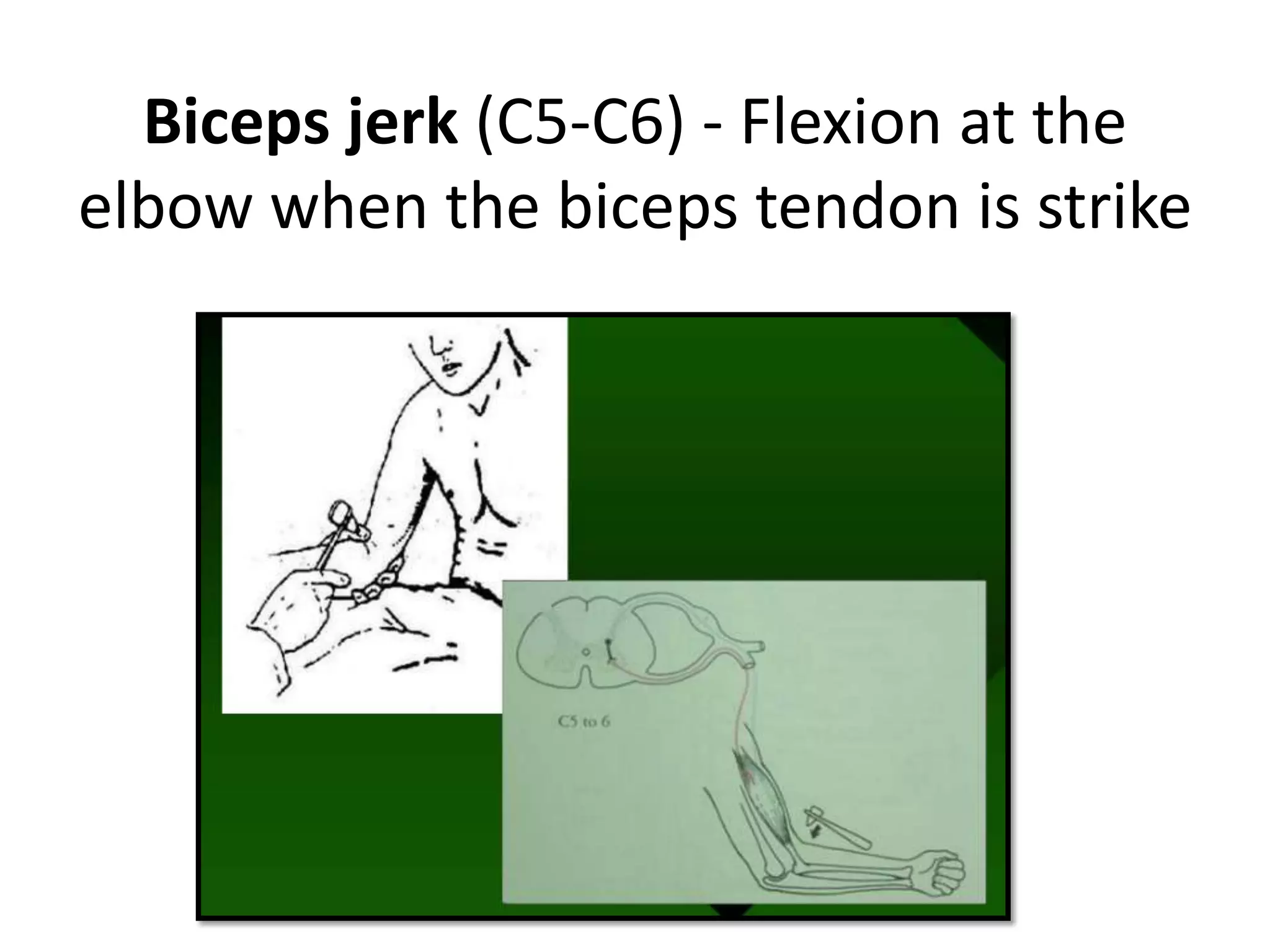 Examination of motor system | PPTX