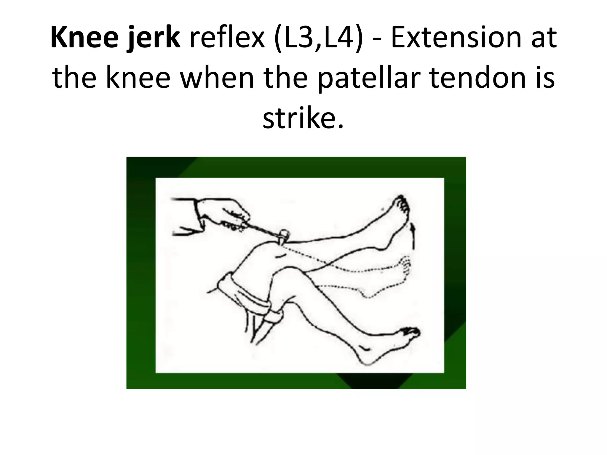 Examination of motor system | PPTX