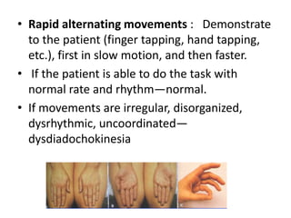 Rapid Alternating Movements