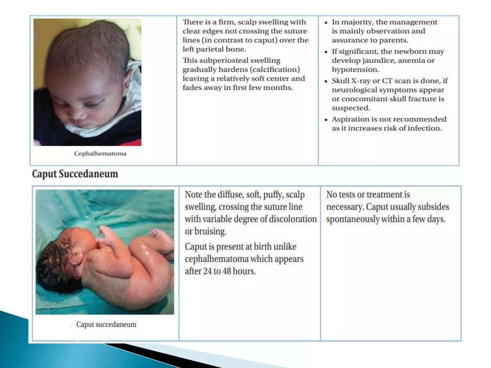 Examination of neonate | PPTX