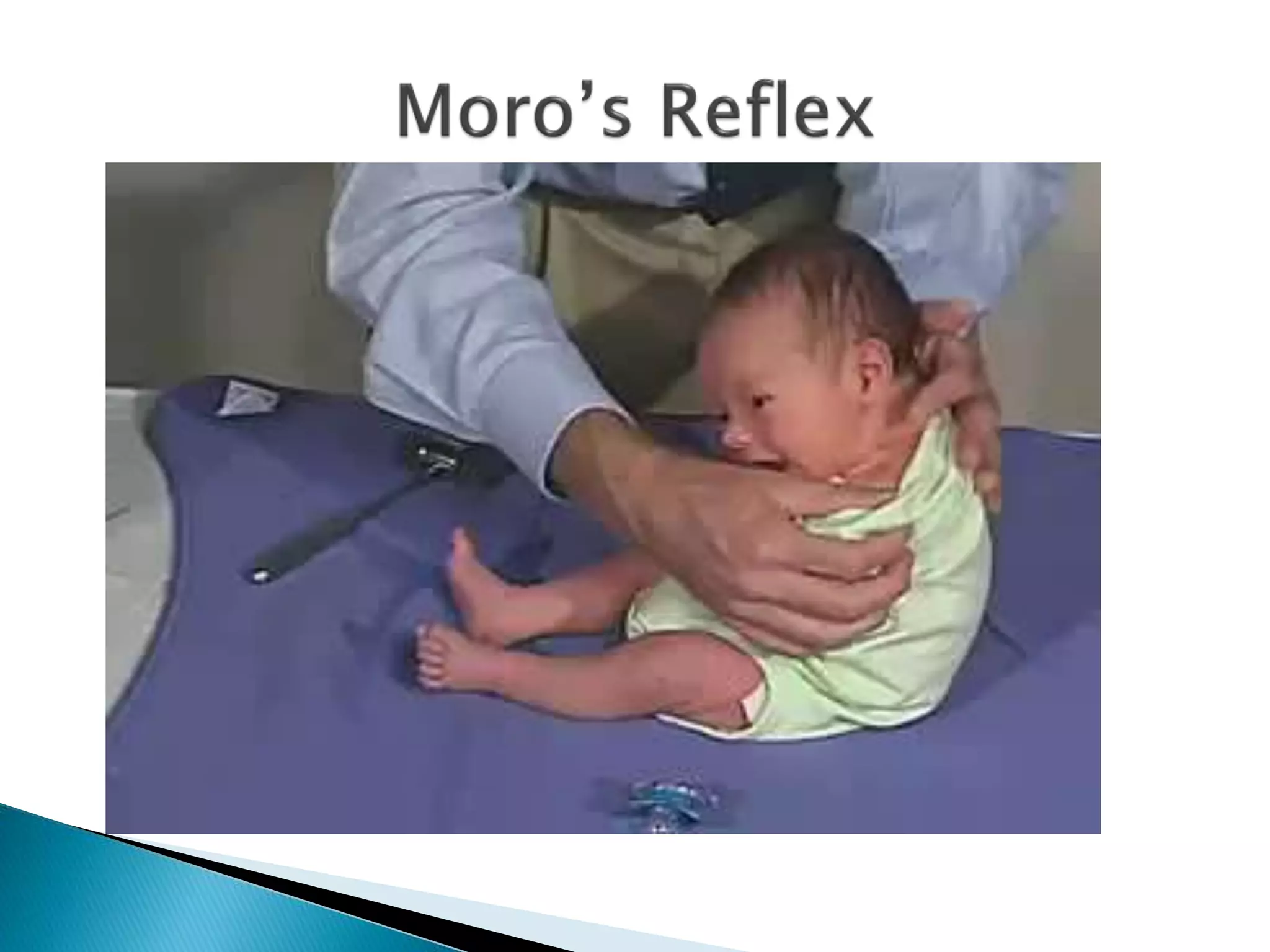 Examination of neonate | PPTX