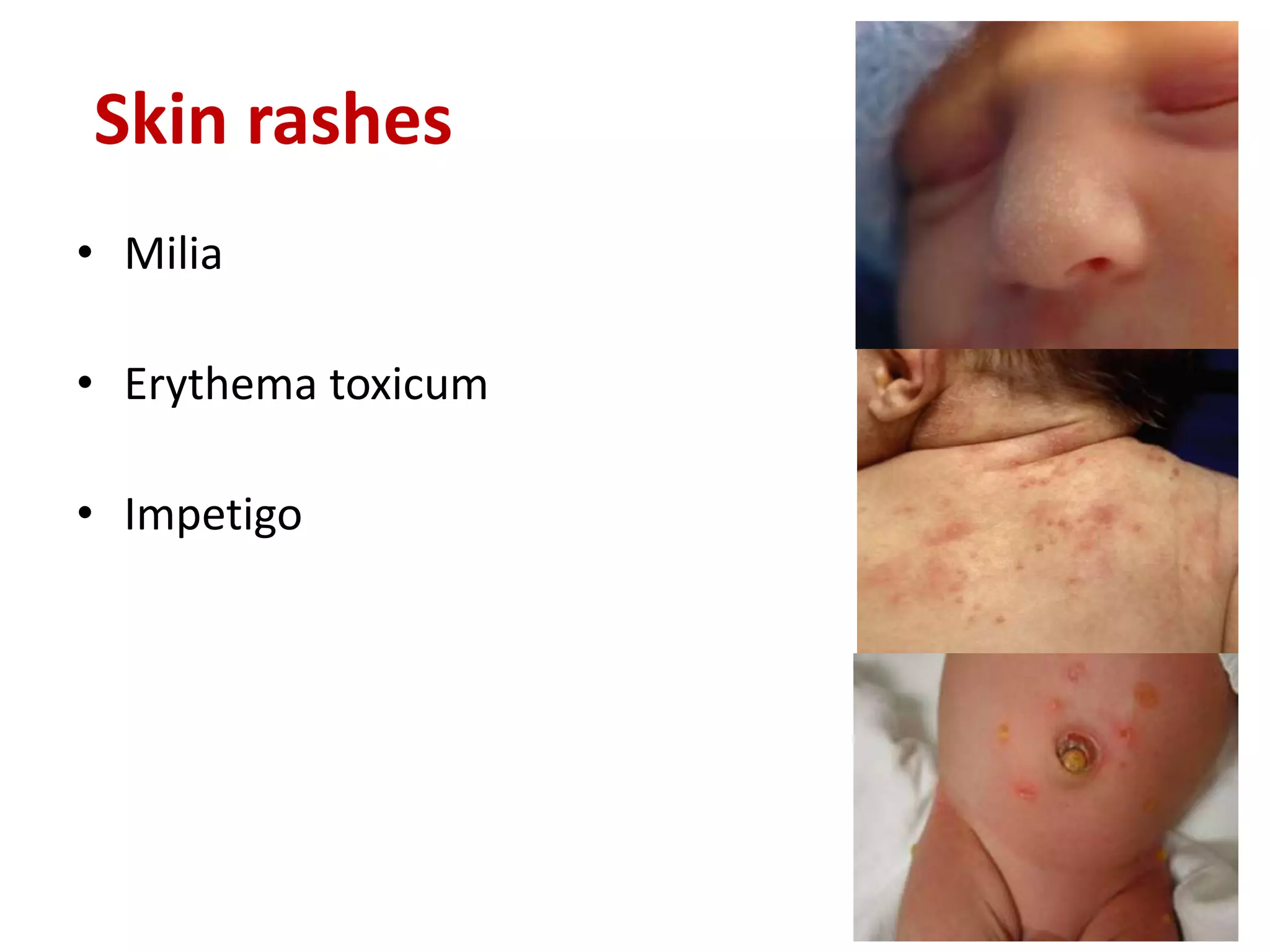 Examination of newborn. | PPTX