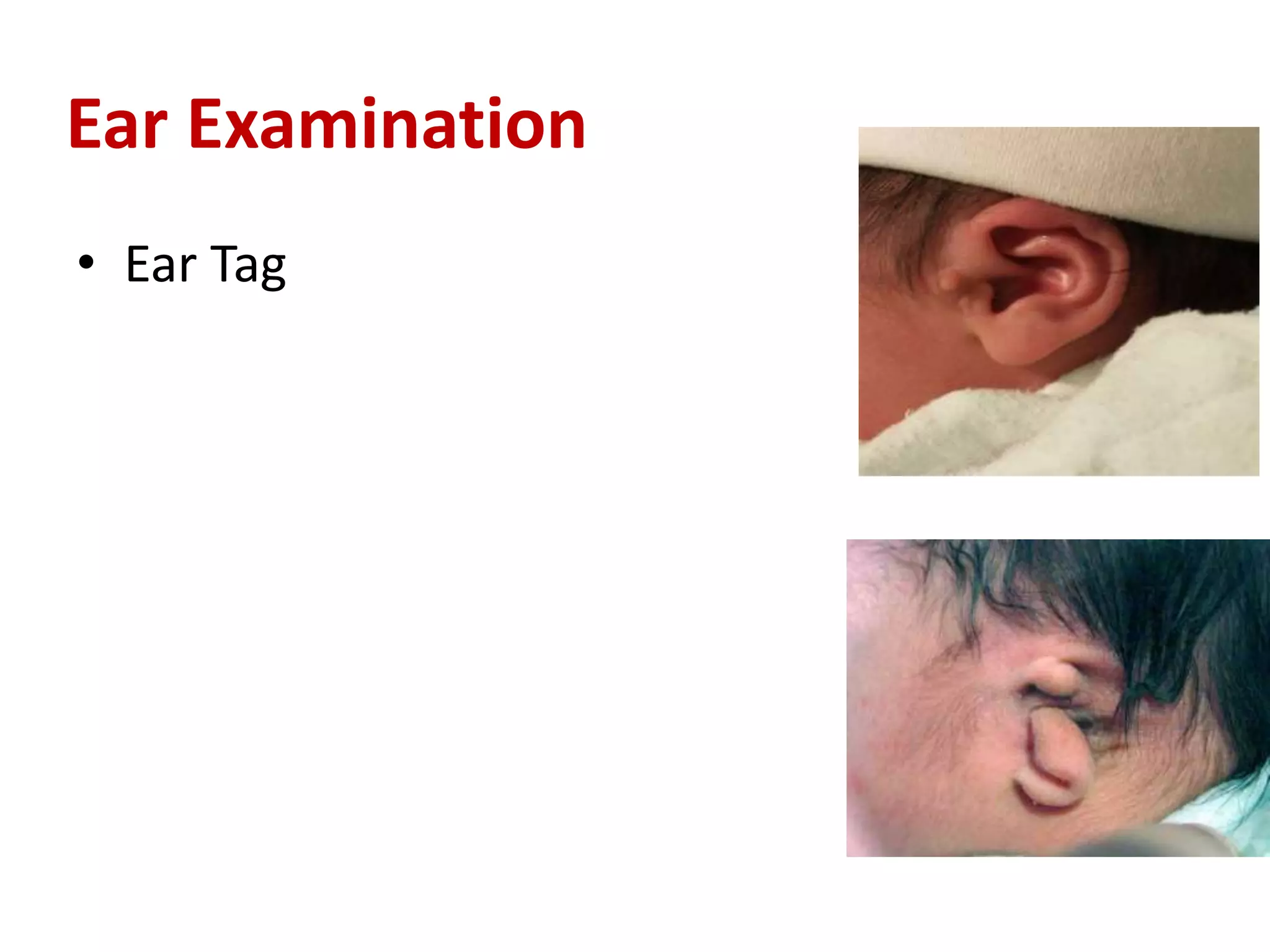 Examination of newborn. | PPTX