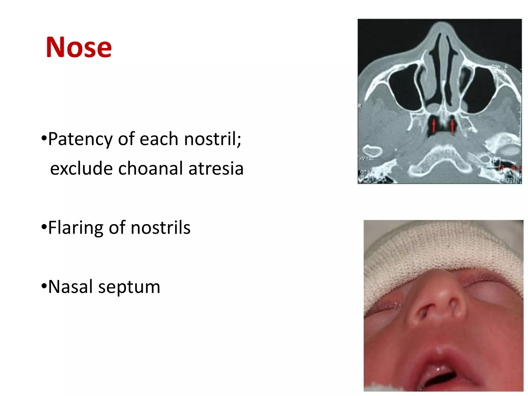 Examination of newborn. | PPTX