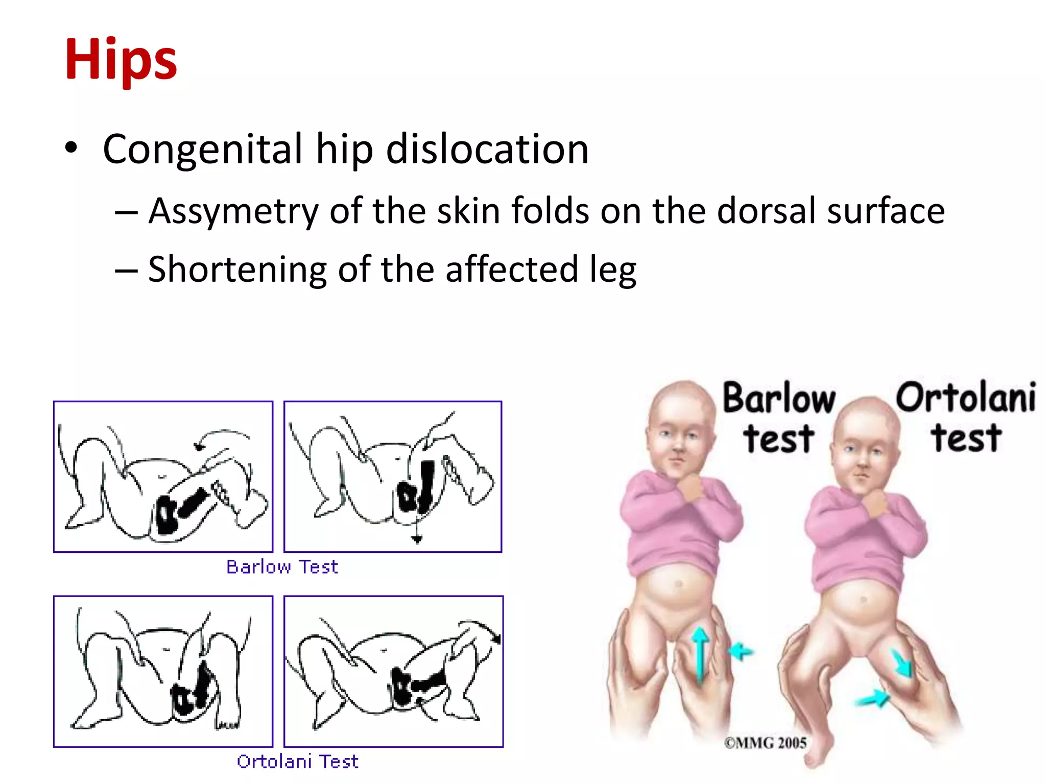 Examination of newborn. | PPTX
