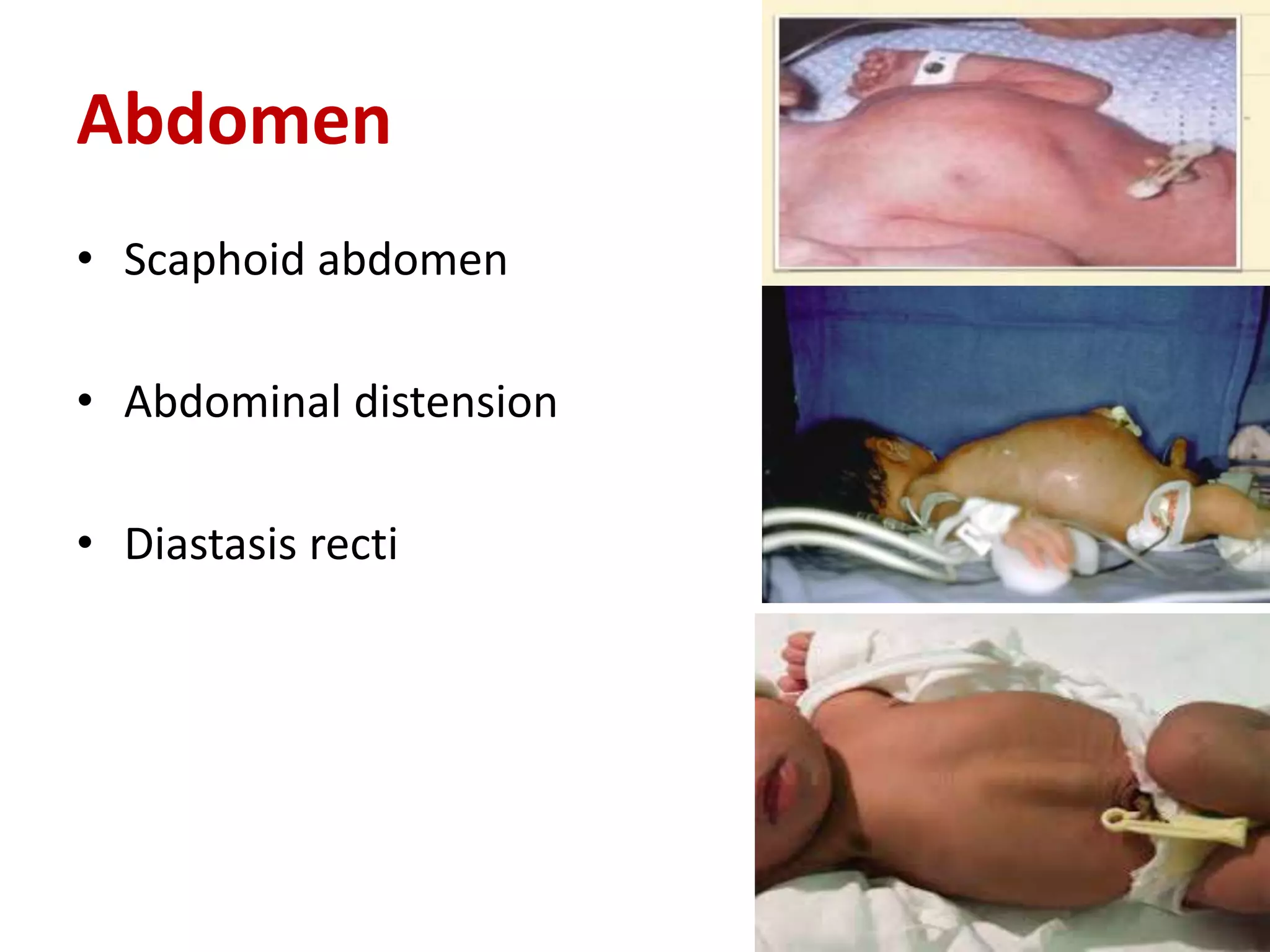 Examination of newborn. | PPTX