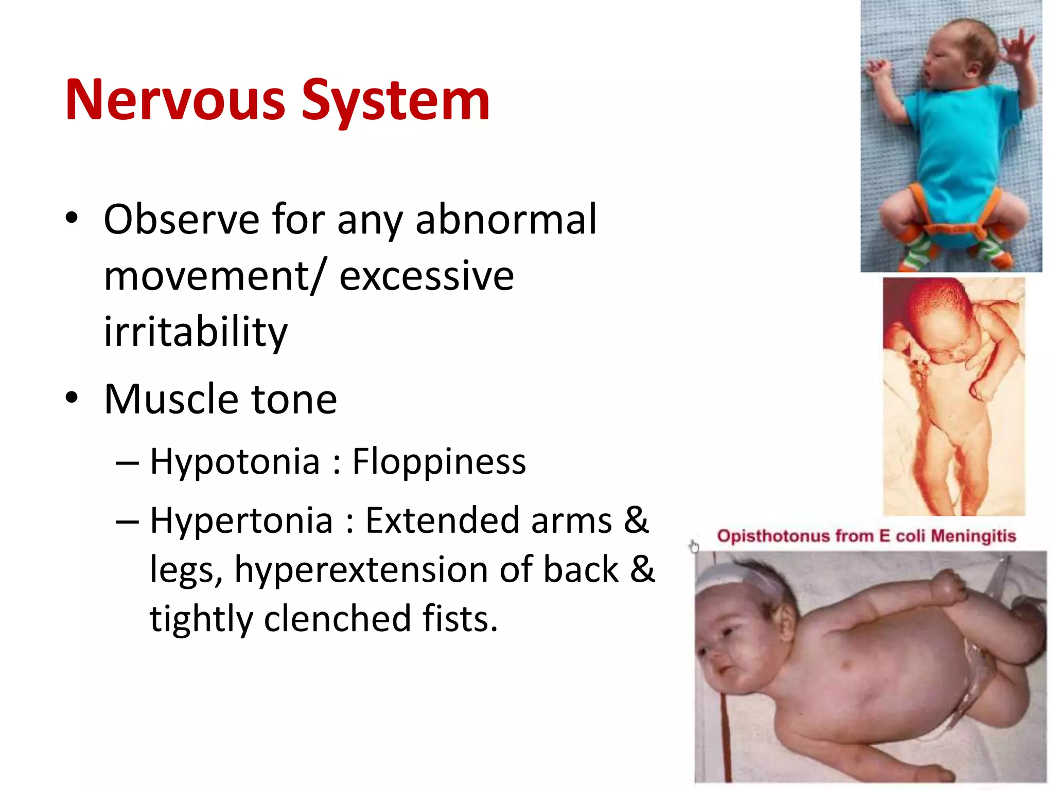 Examination of newborn. | PPTX