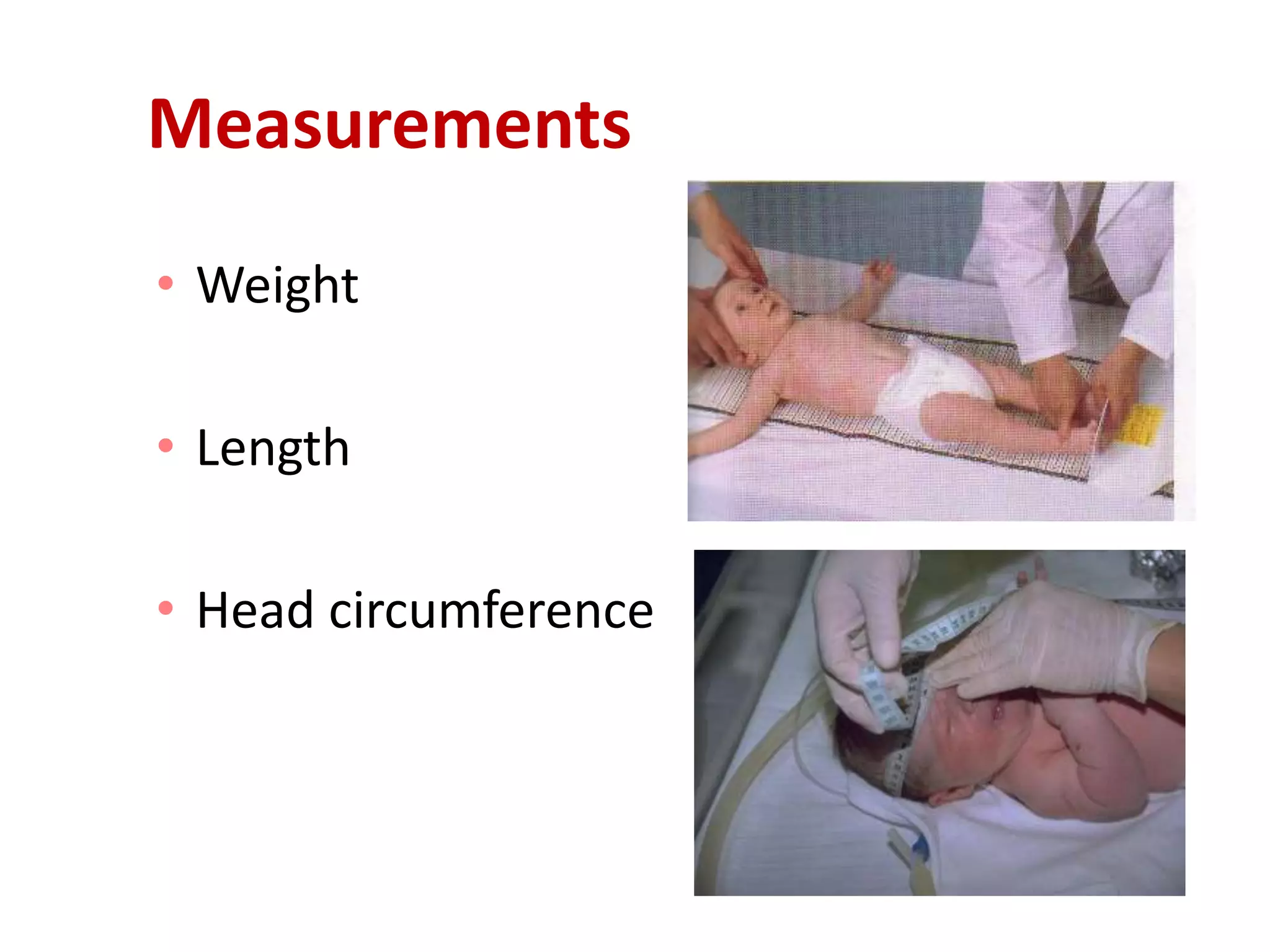 Examination of newborn. | PPTX