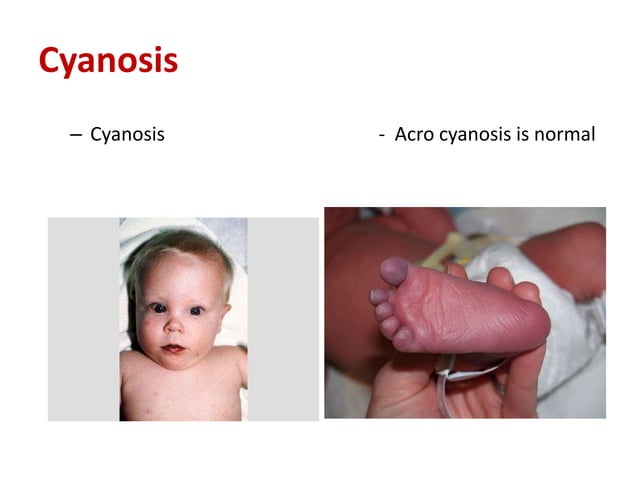 Examination of newborn. | PPTX
