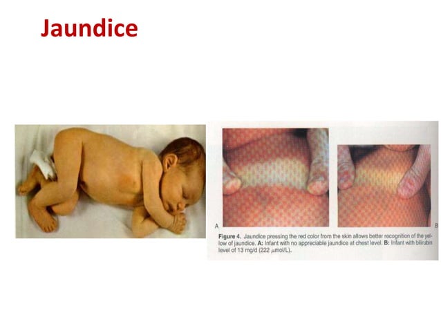 Examination of newborn. | PPTX