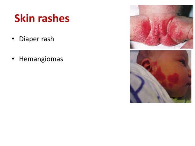 Examination of newborn. | PPTX