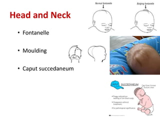 Examination of newborn. | PPTX