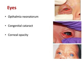 Examination of newborn. | PPTX
