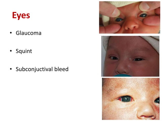 Examination of newborn. | PPTX
