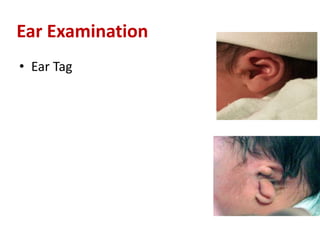 Examination of newborn. | PPTX