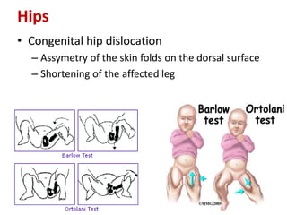 Examination of newborn. | PPTX
