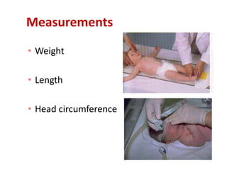 Examination of newborn. | PPTX
