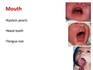 Examination of newborn. | PPT