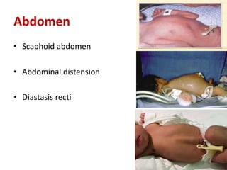 Examination of newborn. | PPT