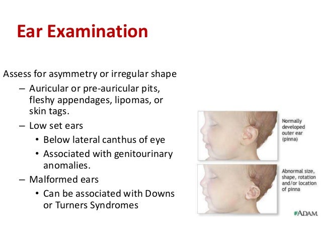 Examination of newborn.