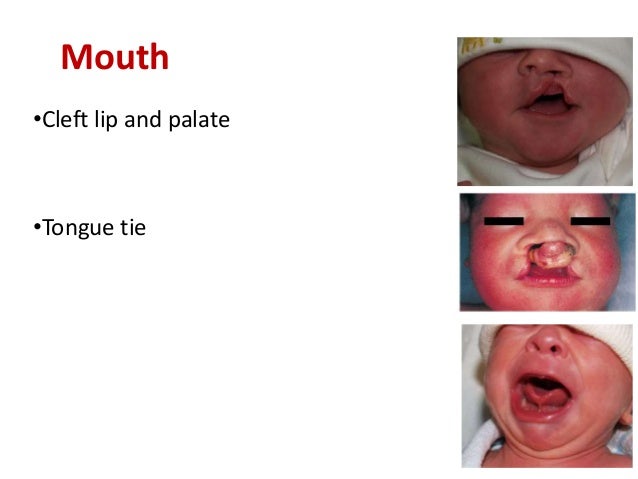 Examination of newborn.