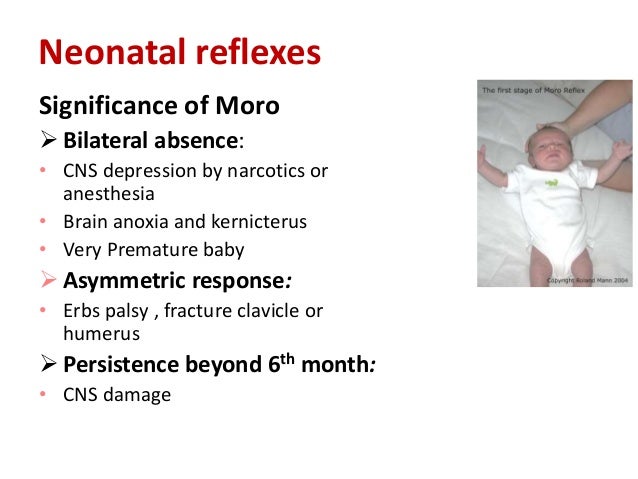 Examination of newborn.