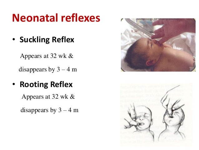 Examination of newborn.