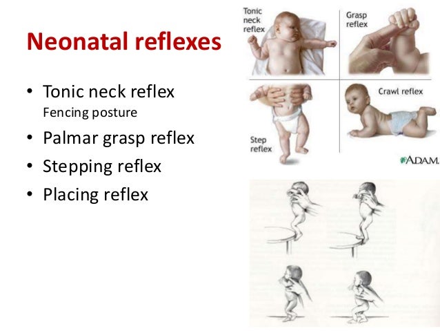 Examination of newborn.