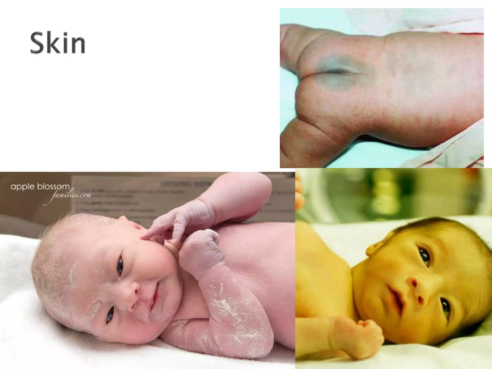 Examination of newborn and Resuscitation | PPTX | First Aid | Injuries