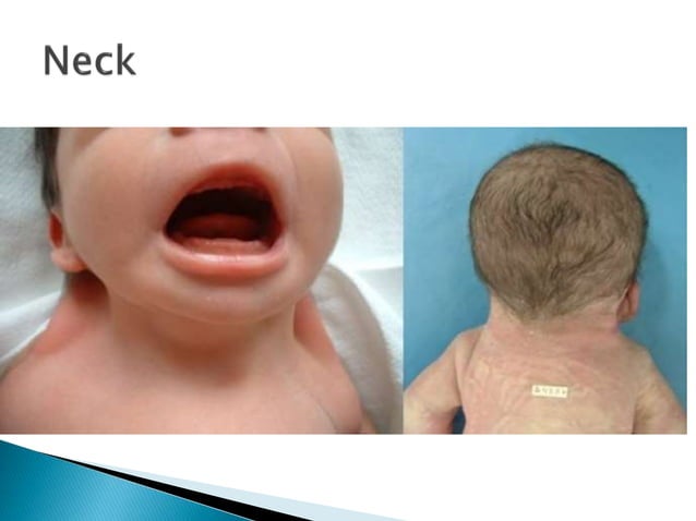 Examination of newborn and Resuscitation | PPTX | First Aid | Injuries
