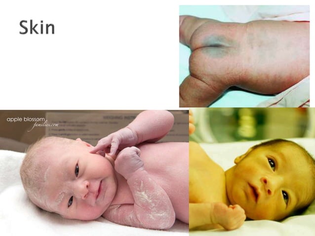Examination of newborn and Resuscitation | PPTX | First Aid | Injuries