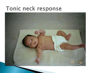 Examination of newborn and Resuscitation | PPTX