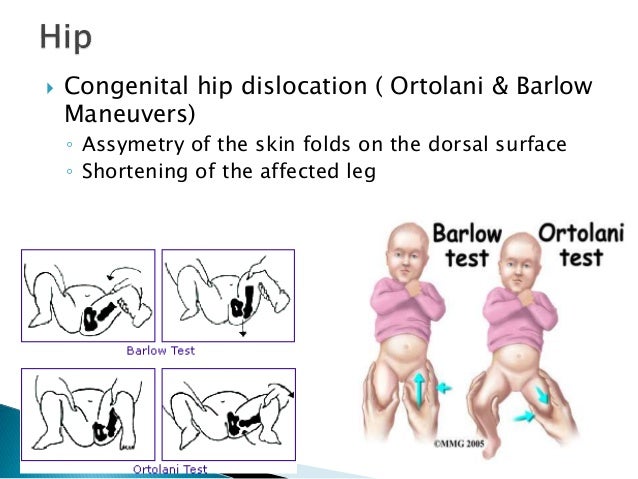 Examination of newborn and Resuscitation