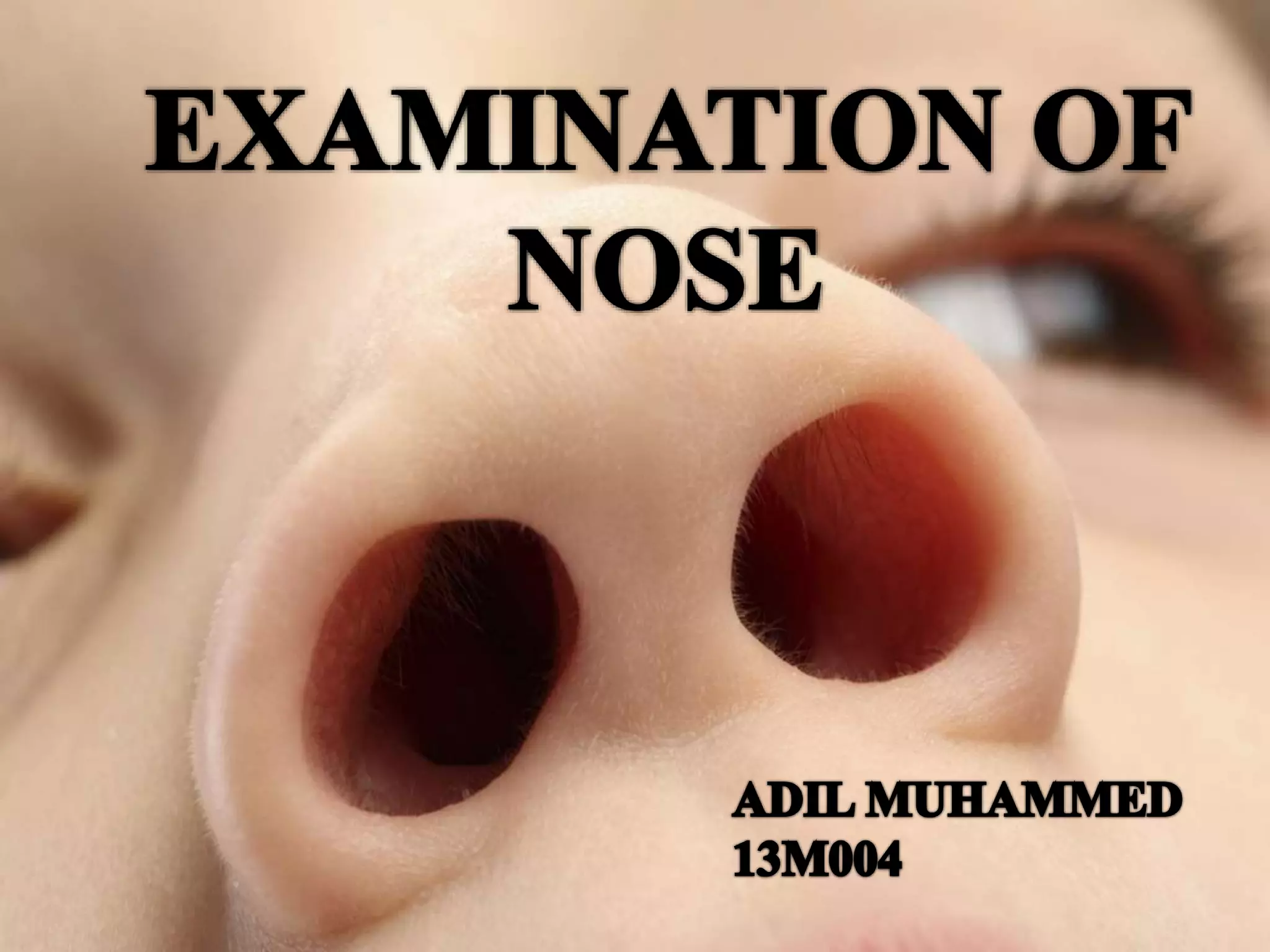 Examination of nose | PPTX