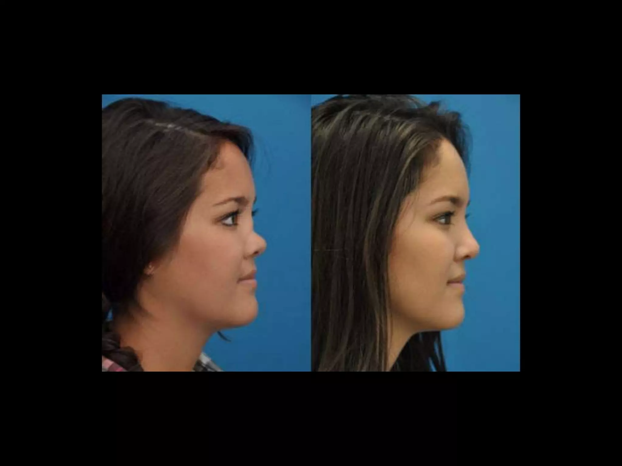 Examination of nose | PPTX