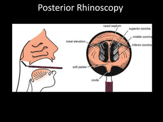 Examination of nose | PPTX