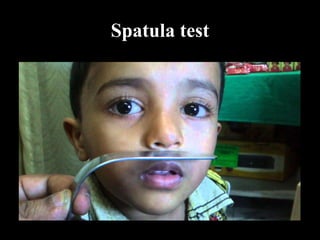 Examination of nose | PPTX