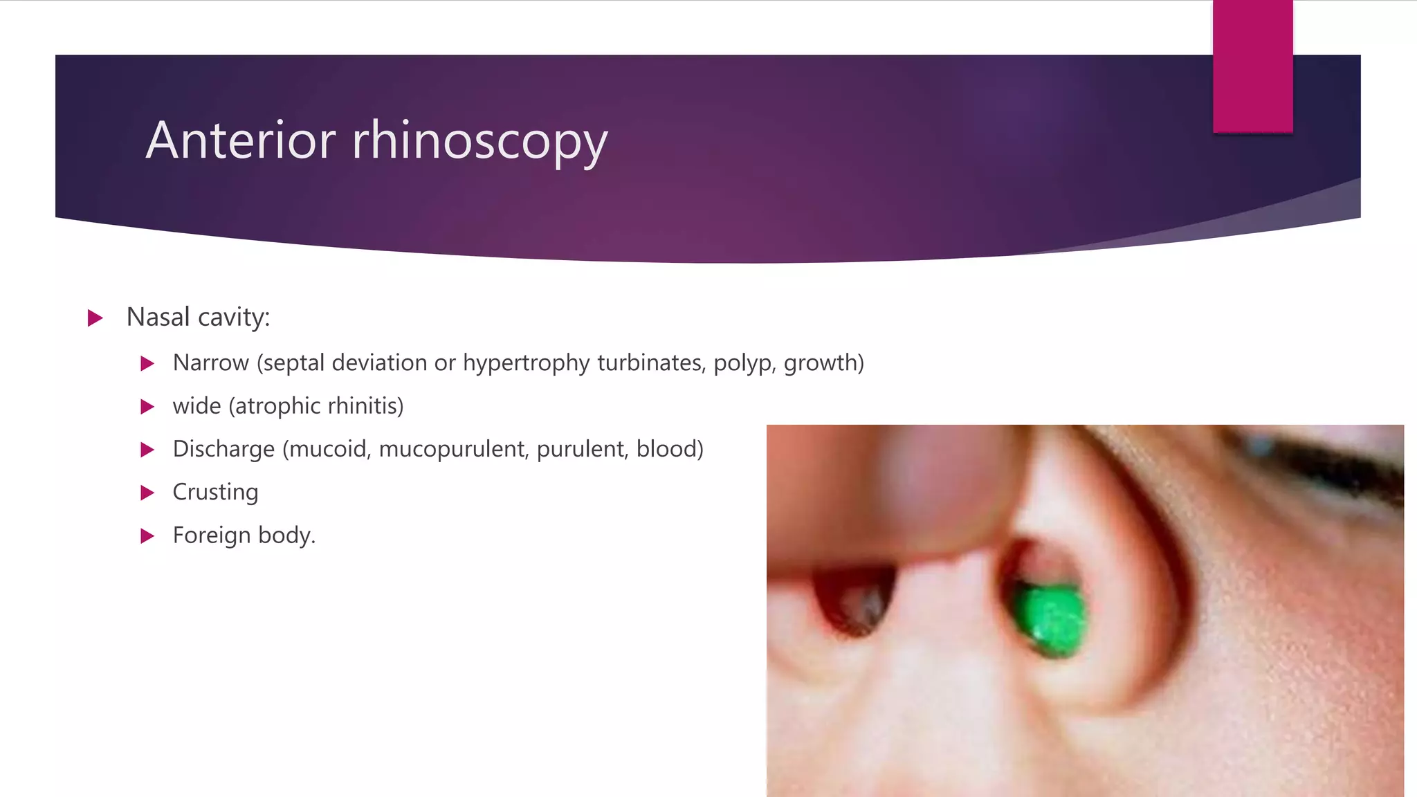 Examination of nose | PPTX