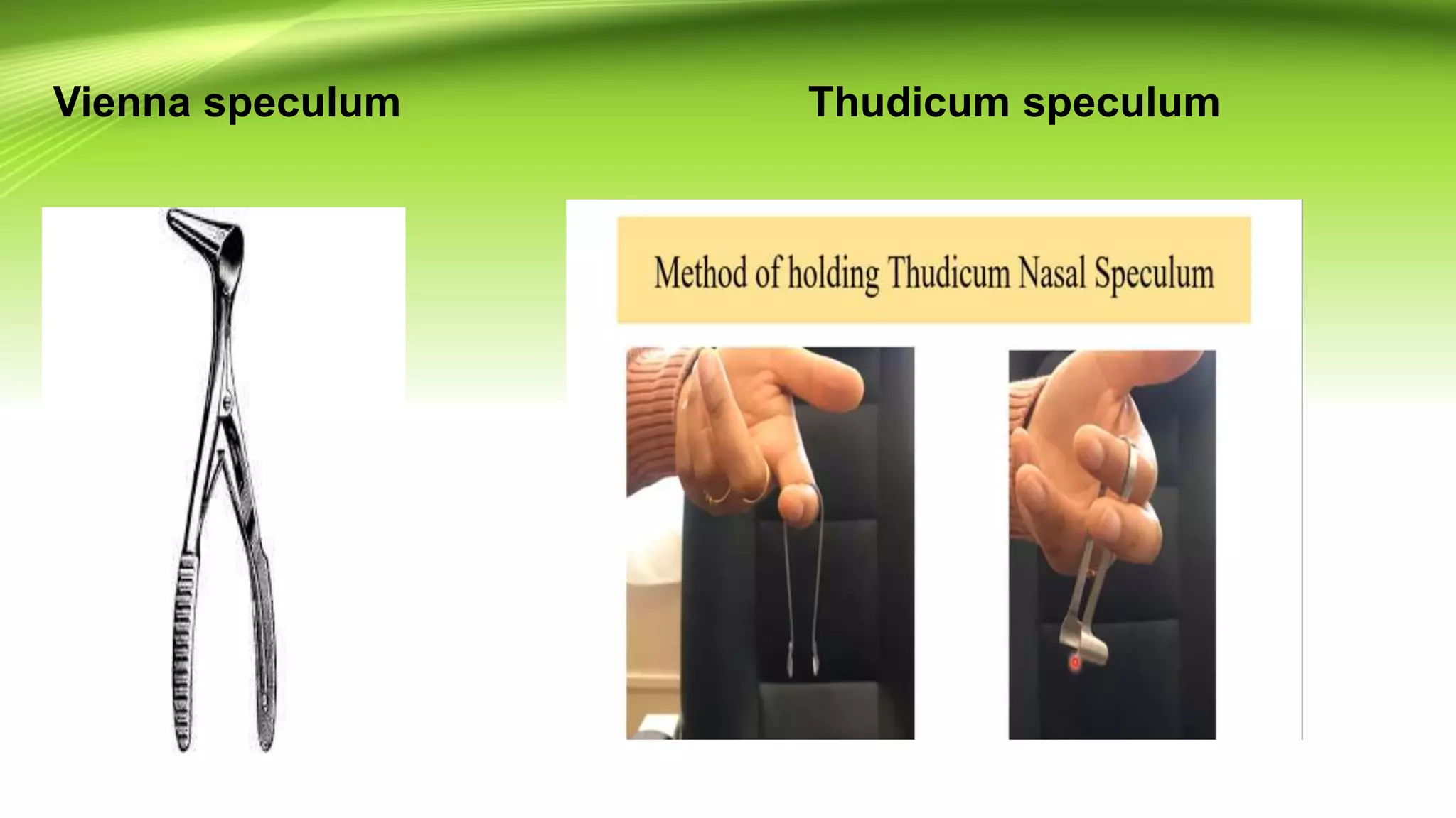 Examination of nose | PPTX