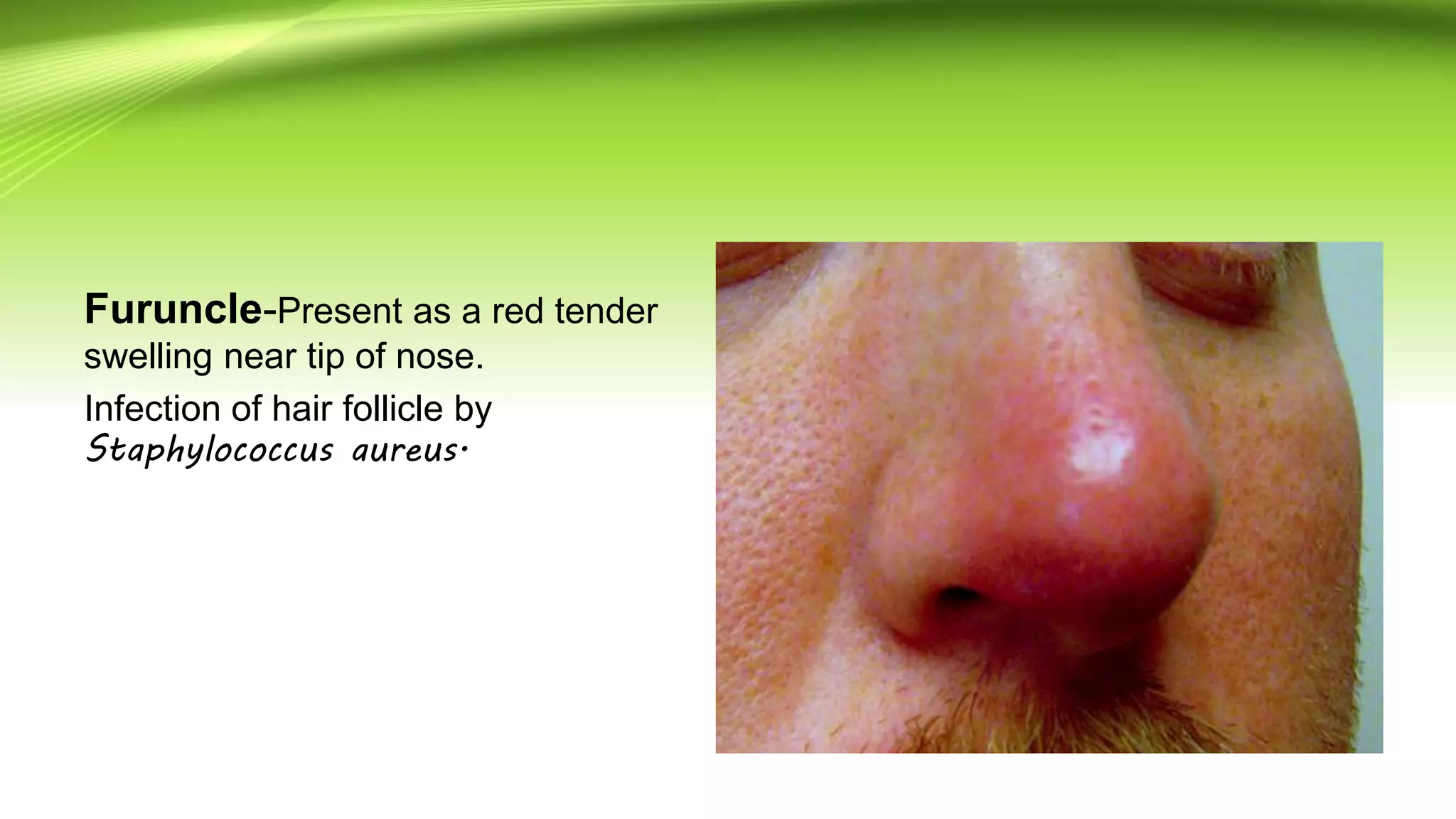 Examination of nose | PPTX